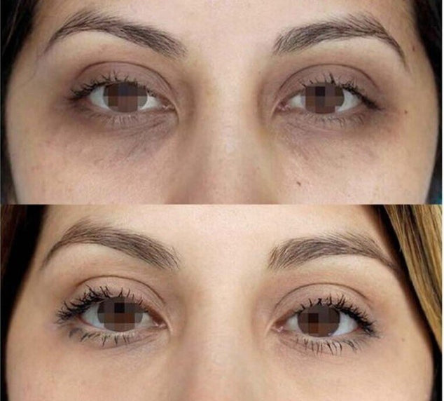 Transform Your Skin's Tone & Texture | Meline Treatment at ...